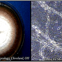 Trichophyton rubrum colony and microscopic appearance (40x).