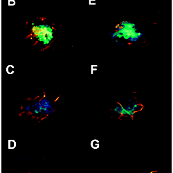 Optoacoustic properties of DOX ex vivo.