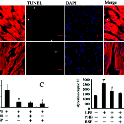 Effects of YHB or/and reserpine (RSP) on the cardiomyocyte apoptosis in ...