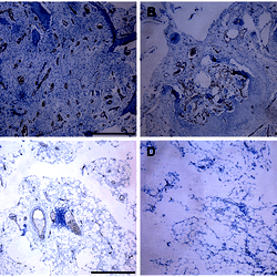 Immunohistochemistry for CD31.