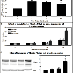 The effect of incubation of fPCLS on viability, gene expression of fibrosis markers and collagen ...