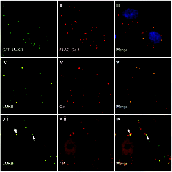 Indirect immunofluorescence shows that LMKB localizes to P-bodies.