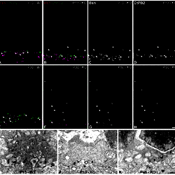 Association of Ribeye and Bassoon at different ages.