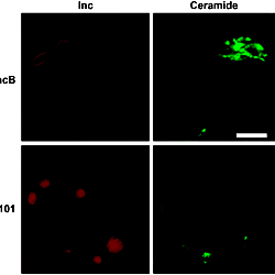 Labeling of CT101 and IncB induced vesicles with C6-NBD-ceramide.