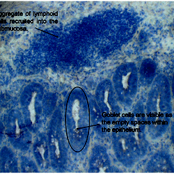 Inflamed mouse colon.