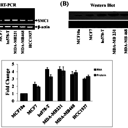 The expression of SMC1 in different breast cancer cells.