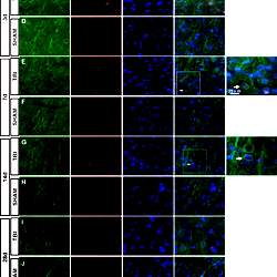 MAP-2+/BrdU+ newborn neurons in the peri-injured cortex.