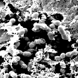 Scanning Electron Microscopy of S. suis Diplococci in a Sheet of Mucus ...