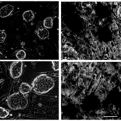 Establishment of mouse iPS cell lines from SOD1G93A mice and C57BL/6 mice.