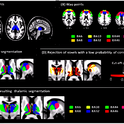 Structural connectivity maps of the thalami: processing pipeline and ...