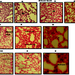 Histopathological images representing the collapsed alveoli ...