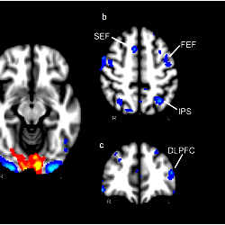 Main effect of intermixed versus novel stimuli.