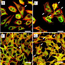 Immunofluorescence staining of vinculin (green) and beta-actin (red) in ...