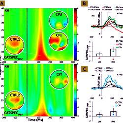 Time-frequency plot of ERSP.