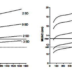 MUAC-for-Age Z-scores according to the gender (boys and girl) from WHO ...