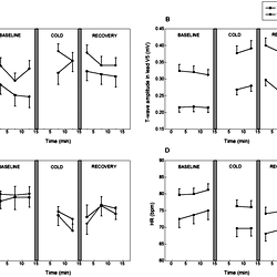 ECG changes during cold exposure.