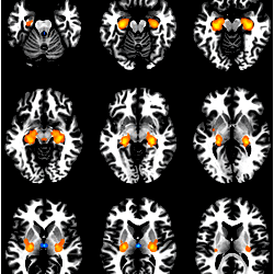 Cluster 1 gene expression pattern.