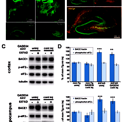 Two-vector AAV system effectively transduces mouse brain, and GADD34 ...