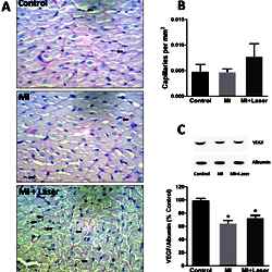 Histological changes and evaluation of capillaries density and VEGF ...