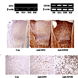 The expression and localization of EPO and EPOR in the developing bones.