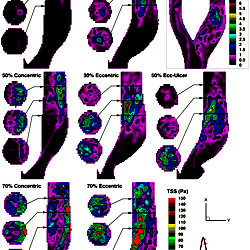 Color-encoded maps of total shear stress for the time point of maximum ...