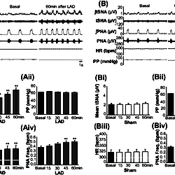 Baseline changes post LAD ligation.