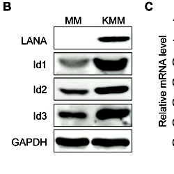 Ids were up-regulated in KSHV-transformed KMM cells.