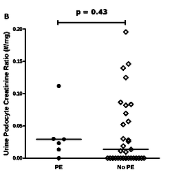 Dot plots of urine podocyte-to-creatinine ratios.
