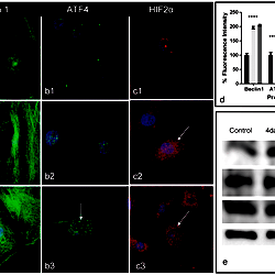 HUVEC confocal images of Beclin 1 (green) (Fig. 2a), ATF4 (green) (Fig ...