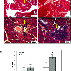 Effects of cerulein on the progression of autoimmune-like pancreatic ...