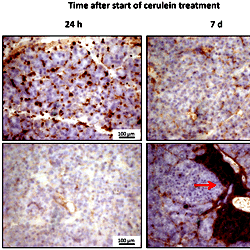 Detection of CD11b-positive and CD3-expressing cells in pancreatic tissue.