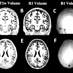 A comparison of in vivo MRI based cortical myelin mapping using T1w/T2w ...