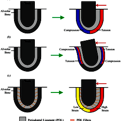 Simplified two dimensional representation of a tooth-PDL-bone complex ...
