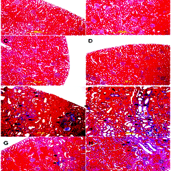 Representative photograph of sections of renal tissue of rats treated ...