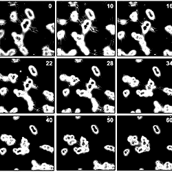 Thrombin causes neurite retraction in differentiated PC12 cells.