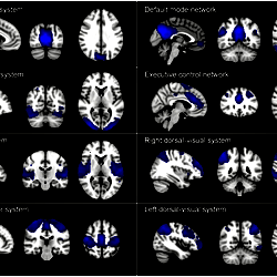 Resting state network maps.
