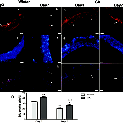 Representative images of EdU staining of common carotid arteries in ...