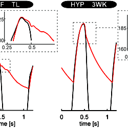 Left ventricular- and aortic blood pressure tracings simulated using ...