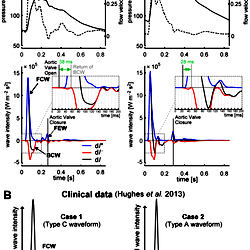 Wave intensity analysis.