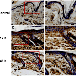 IHC assay showing the changes of Hsp90α immunostaining in burned mouse ...