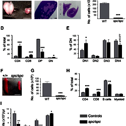 Lymphoid and blood abnormalities in spc mice.