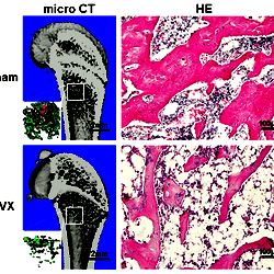 Establishment of rat osteoporotic model created by OVX.