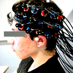 Typical optode array placement.