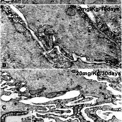 Transmission electron microscopy of the inner circular layer (icl).
