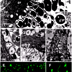 The gut and protonephridia.