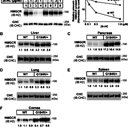 Accumulation of HMGCR protein in tissues of Ubiad1G184R/+ mice.
