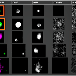 Different types of events presented by the CellSearch System.
