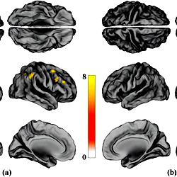 Within group analysis of 2-back task.