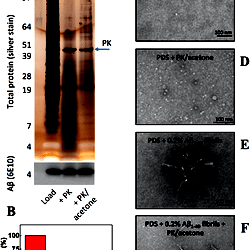 Effect of proteinase K digestion and acetone precipitation on the ...