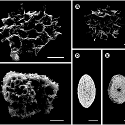 Free-floating microphyte components (chloroccocalean microalgae).